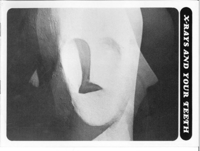 "X-Rays and Your Teeth (1965)" by American Dental Association
